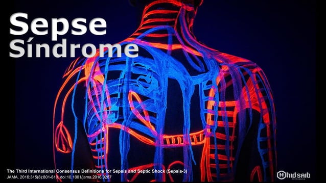 Terceiro consenso internacional de definições sobre sepse e choque ...