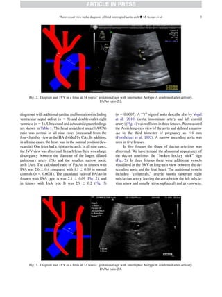 The three vessel view in the fetal mediastinum in the diagnosis | PDF