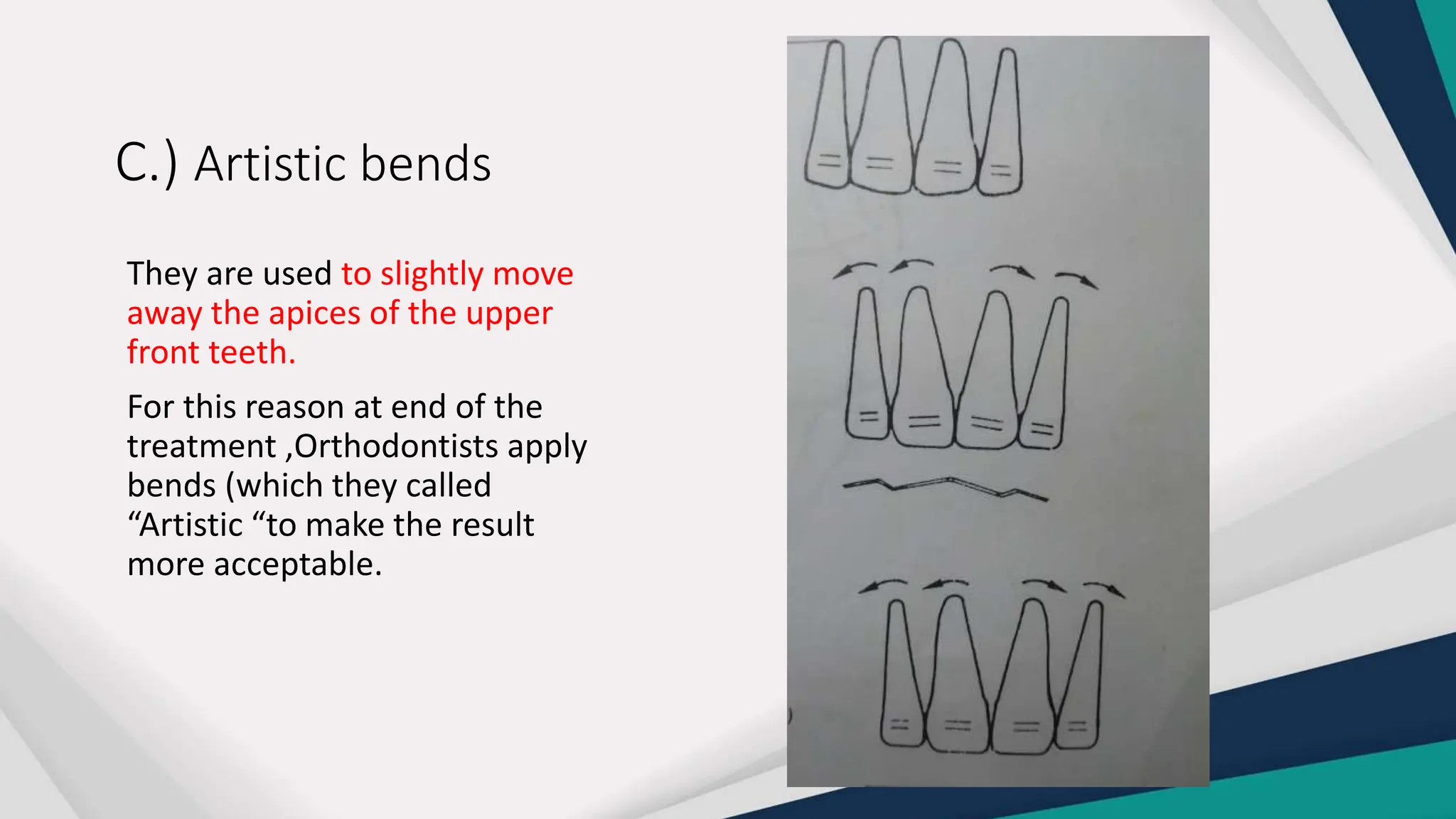 THE THREE ORDER BENDS in STANDARD EDGEWISE TECHNIQUE.pptx