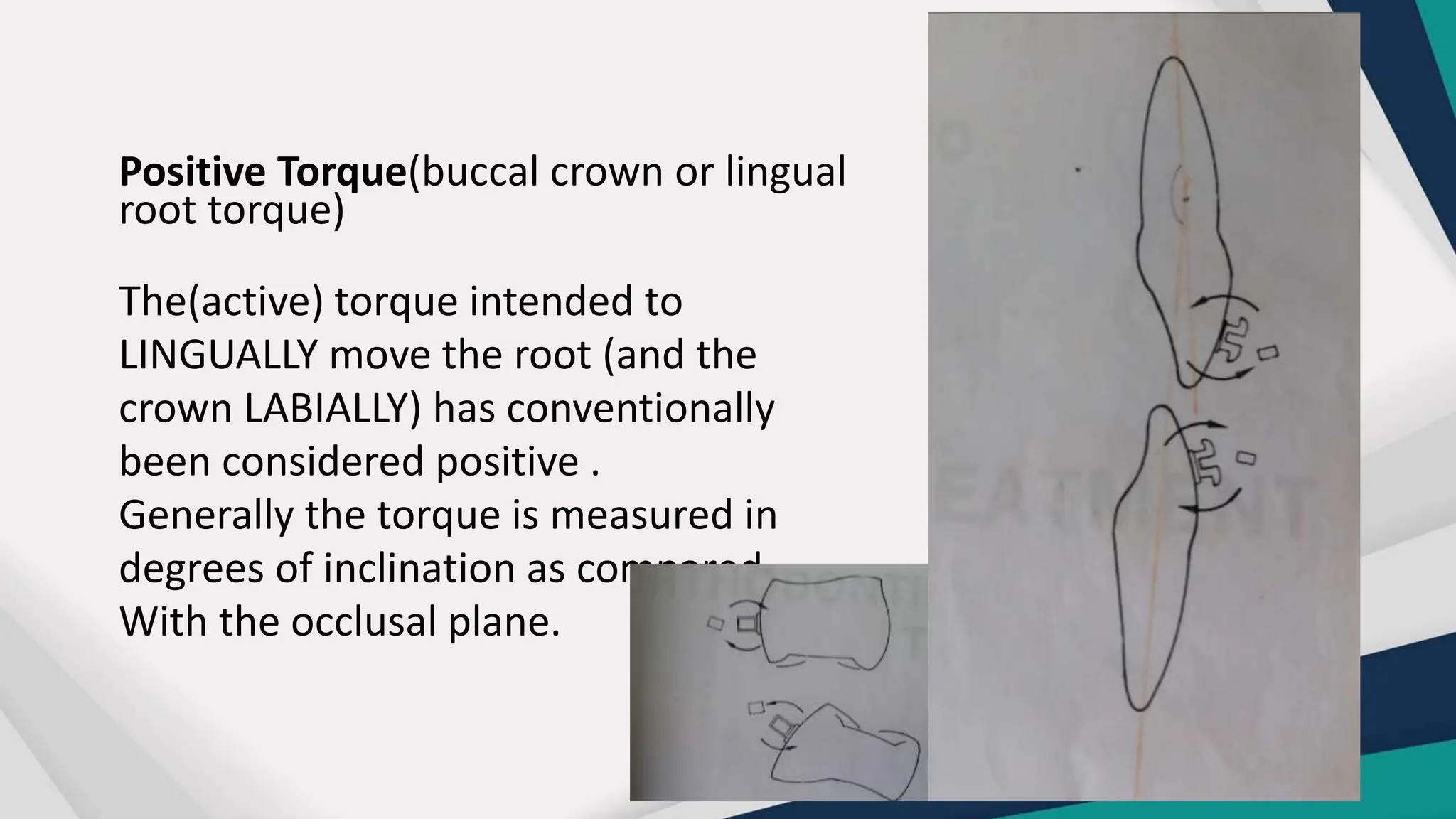 THE THREE ORDER BENDS in STANDARD EDGEWISE TECHNIQUE.pptx