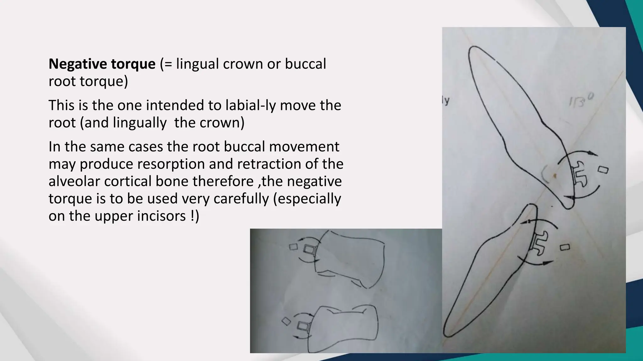 THE THREE ORDER BENDS in STANDARD EDGEWISE TECHNIQUE.pptx