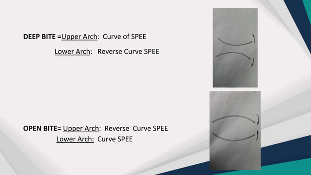 THE THREE ORDER BENDS in STANDARD EDGEWISE TECHNIQUE.pptx