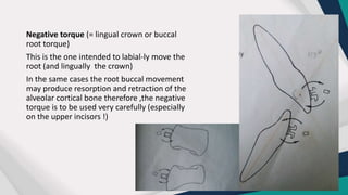 THE THREE ORDER BENDS in STANDARD EDGEWISE TECHNIQUE.pptx