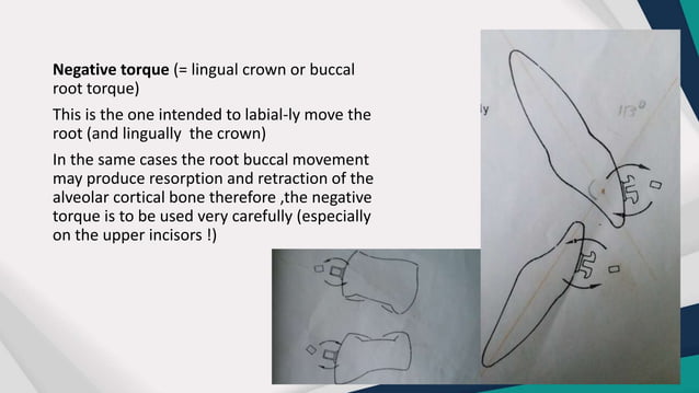 THE THREE ORDER BENDS in STANDARD EDGEWISE TECHNIQUE.pptx