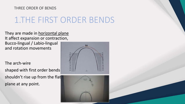 THE THREE ORDER BENDS in STANDARD EDGEWISE TECHNIQUE.pptx