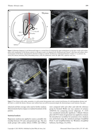 The thymic thoracic ratio in fetal heart defects 22 q 11 | PDF