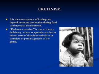 The thyroid and parathyroid glands | PPT