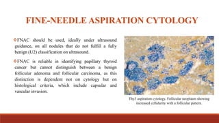 The Thyroid gland ppt and throidectomy.pptx