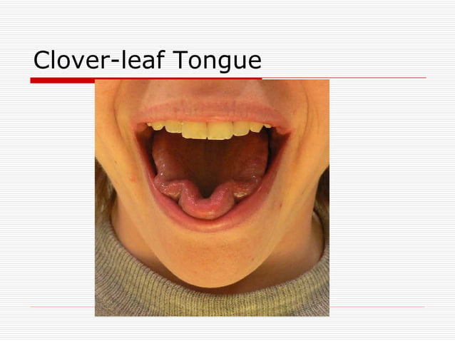 The Tongue!! | PPT