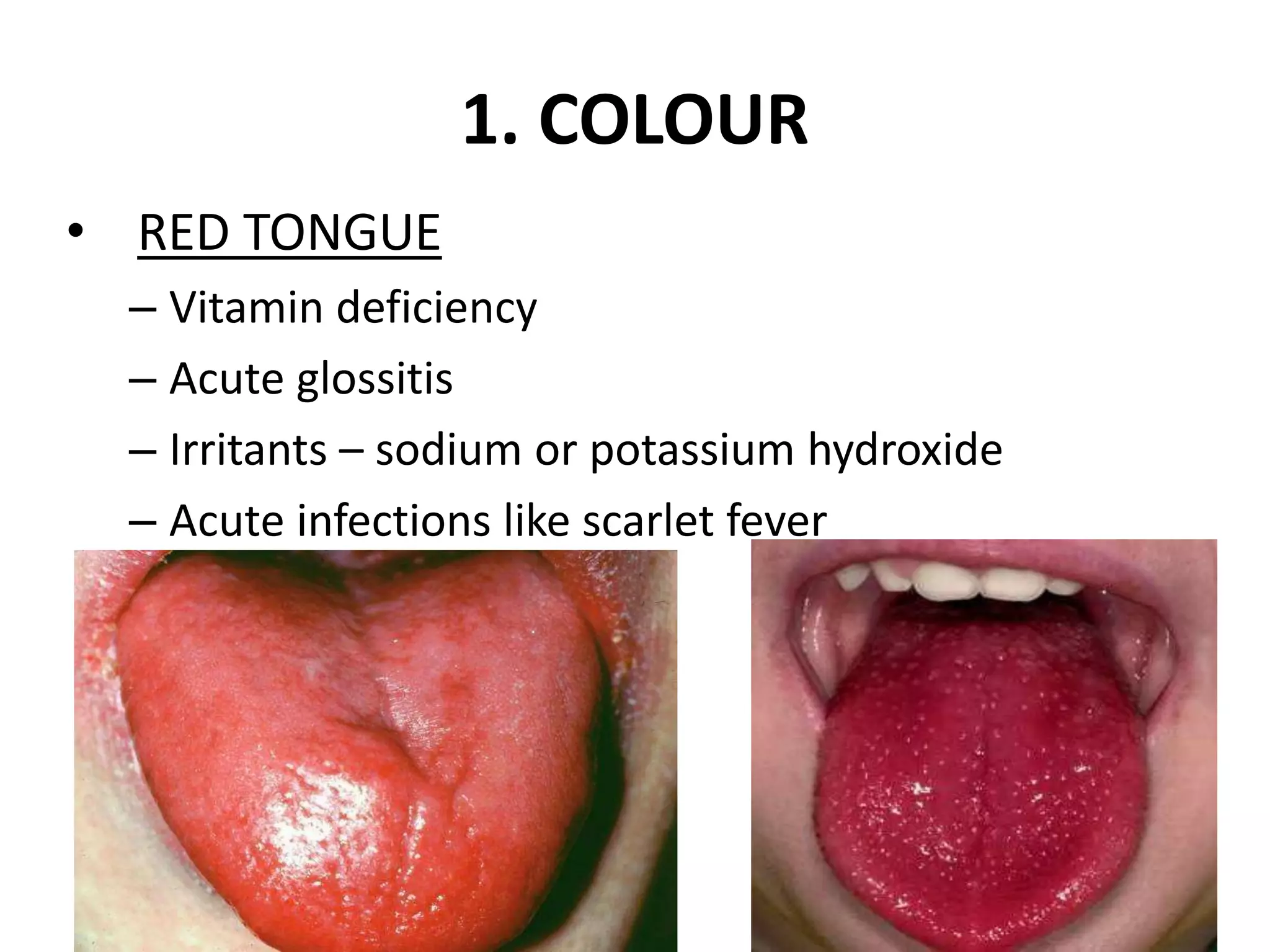 THE TONGUE IN HEALTH AND SICKNESS.pptx