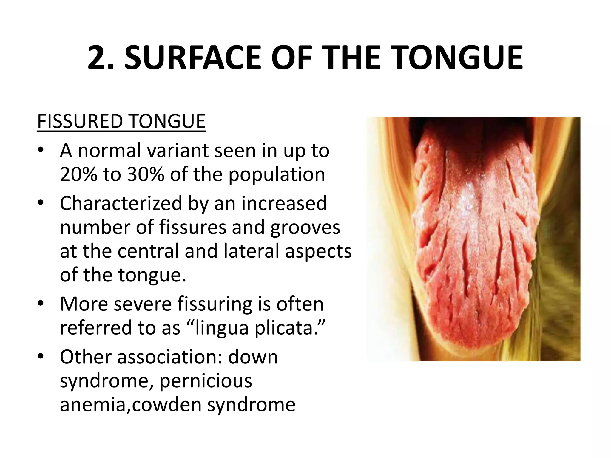 THE TONGUE IN HEALTH AND SICKNESS.pptx