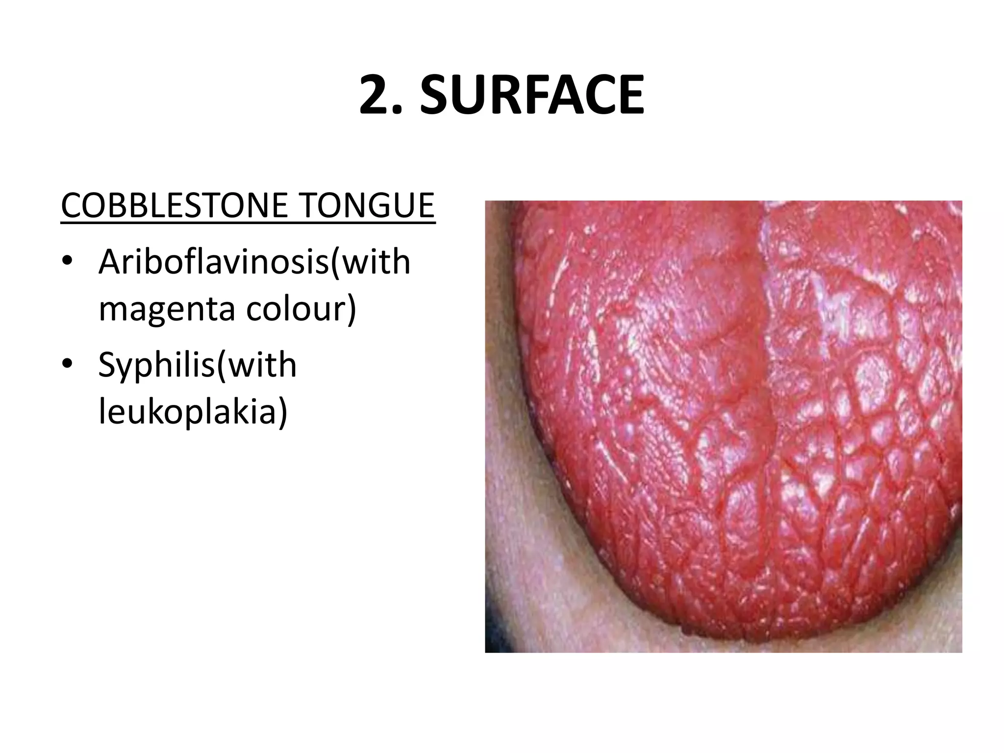THE TONGUE IN HEALTH AND SICKNESS.pptx | Ear, Nose and Throat ...