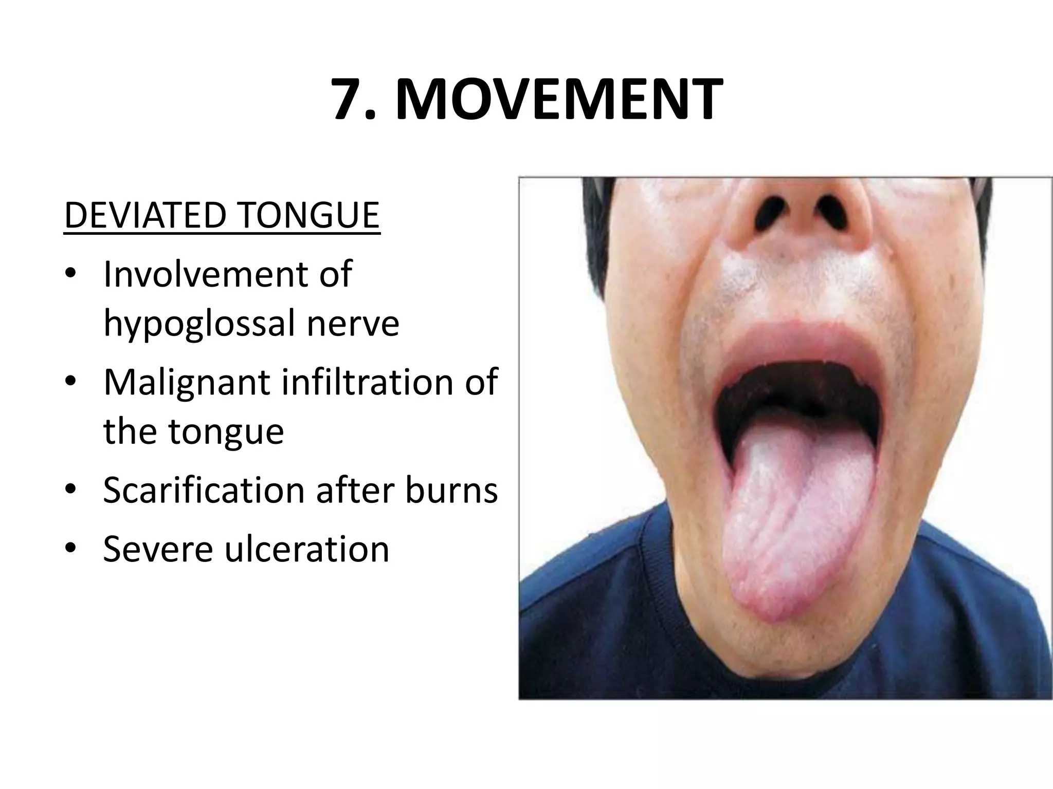THE TONGUE IN HEALTH AND SICKNESS.pptx