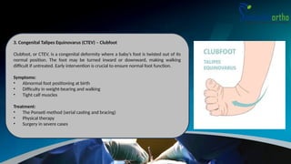 The Top 4 Foot and Ankle Injuries in Kids and Teens. | PPT