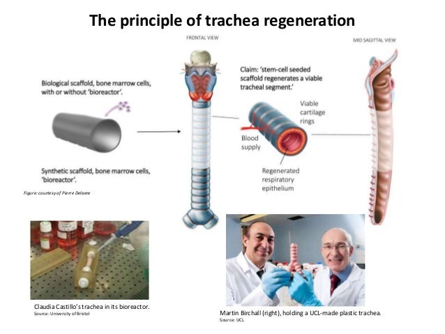 The Trachea Transplanters