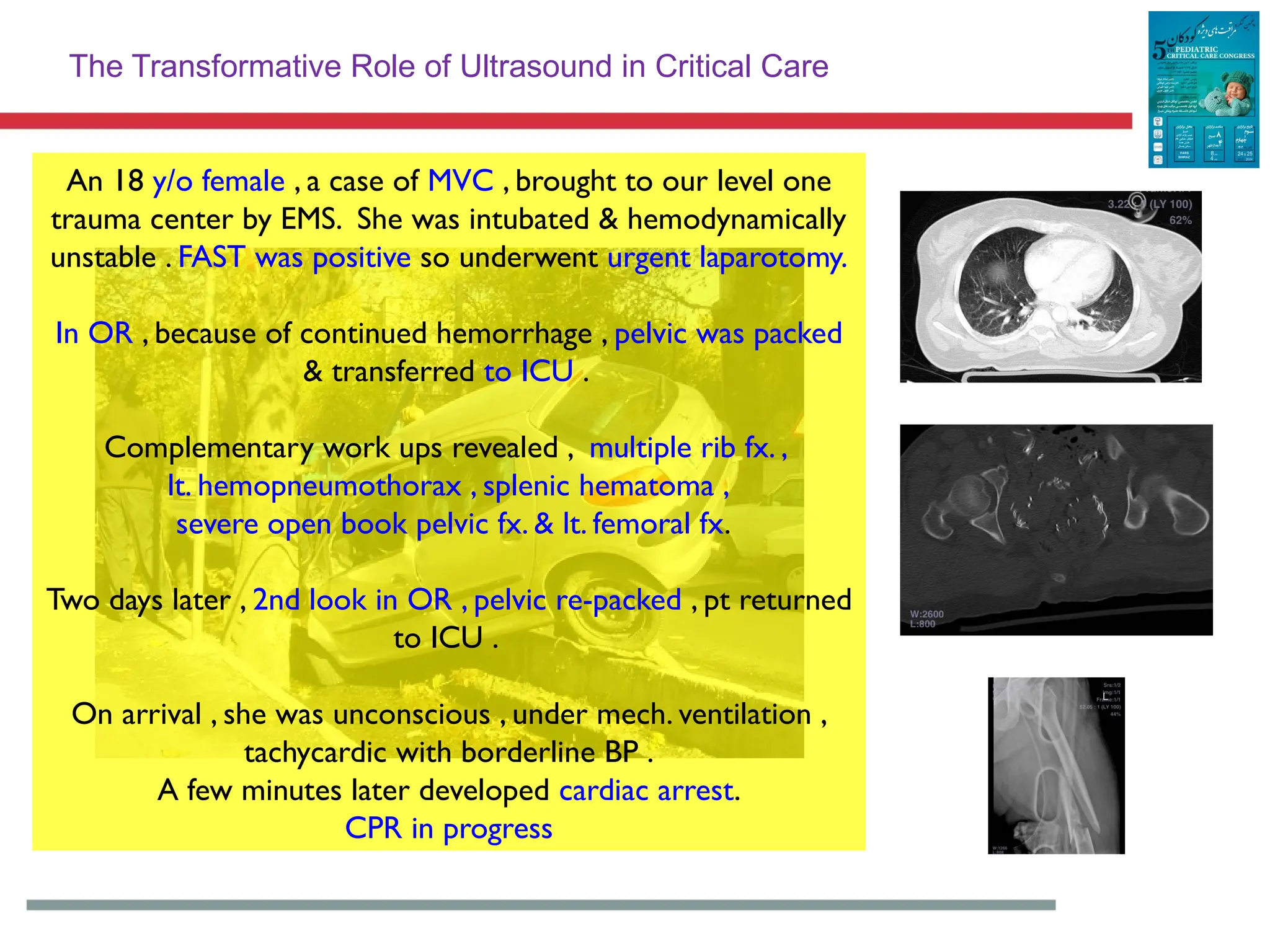 TheTransformative Role of Ultrasound in Critical Care ppt.pptx