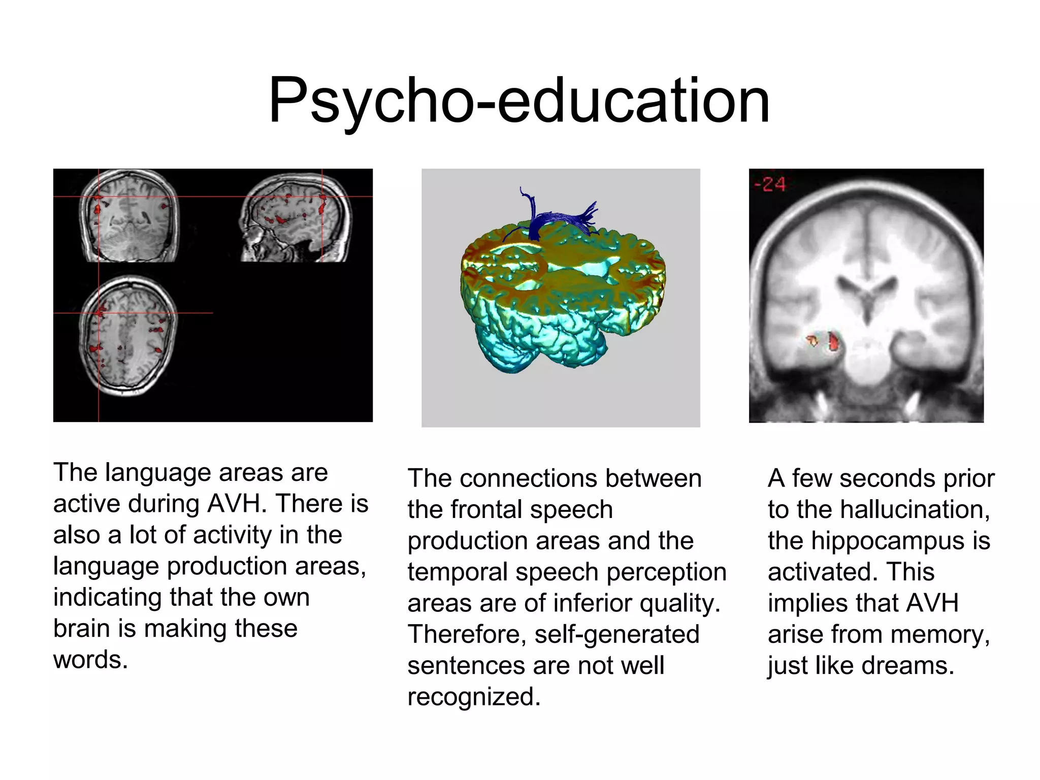 The treatment of auditory hallucinations | PPT