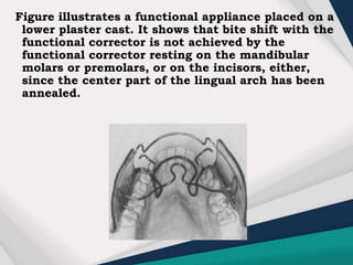 THE TREATMENT OF CLASS II, DIVISION 1 MALOCCLUSION WITH FUNCTIONAL ...