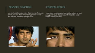 The trigeminal nerve | PPT