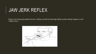 The trigeminal nerve | PPT