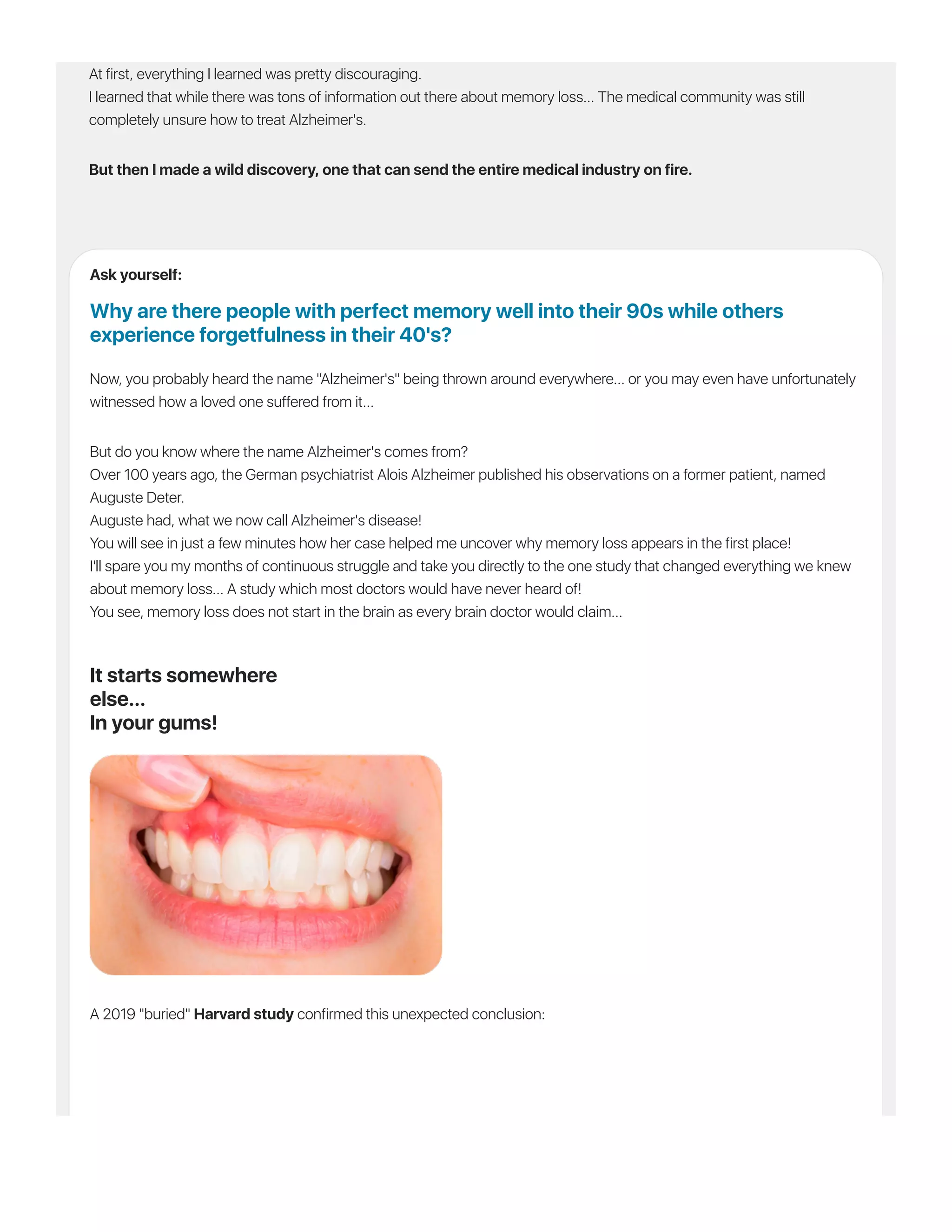 The Truth About Memory Loss | PDF