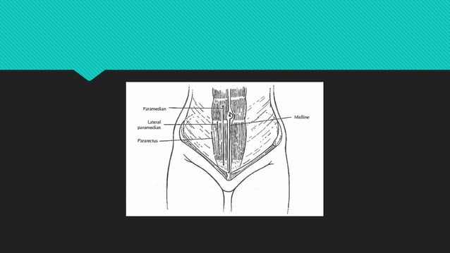 Tipo de incisiones abdominales. Cirugía. | PDF
