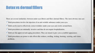 The ultimate botox under eyes guide | PPT
