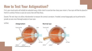 The Ultimate Guide to Astigmatism.pdf