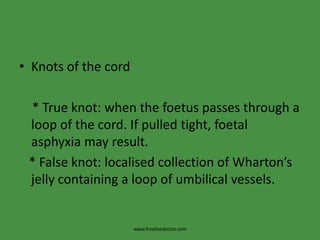 False Knot Umbilical Cord