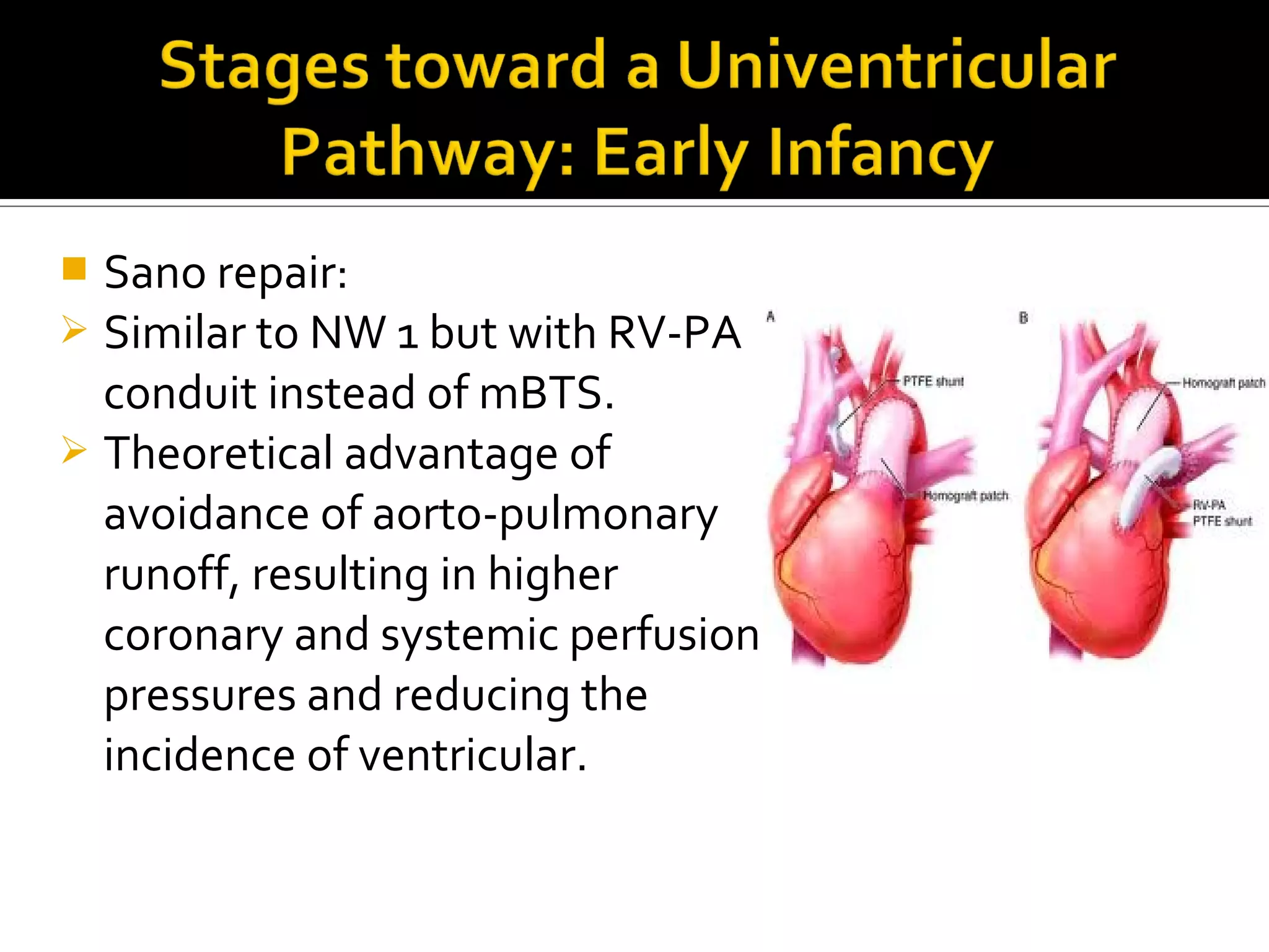 The univentricular repair indications, procedures, outcomes and ...
