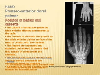 the upper limb | PPTX