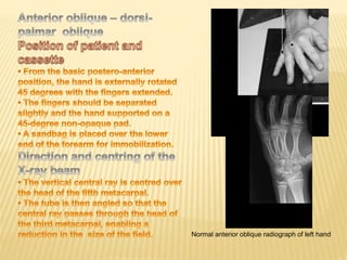 the upper limb | PPTX