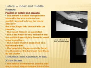 the upper limb | PPTX