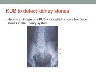 The urinary system | PPT