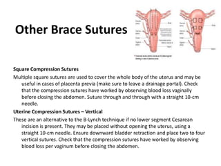 The use of algorithms & emergency boxes in obstetric emergency | PPT