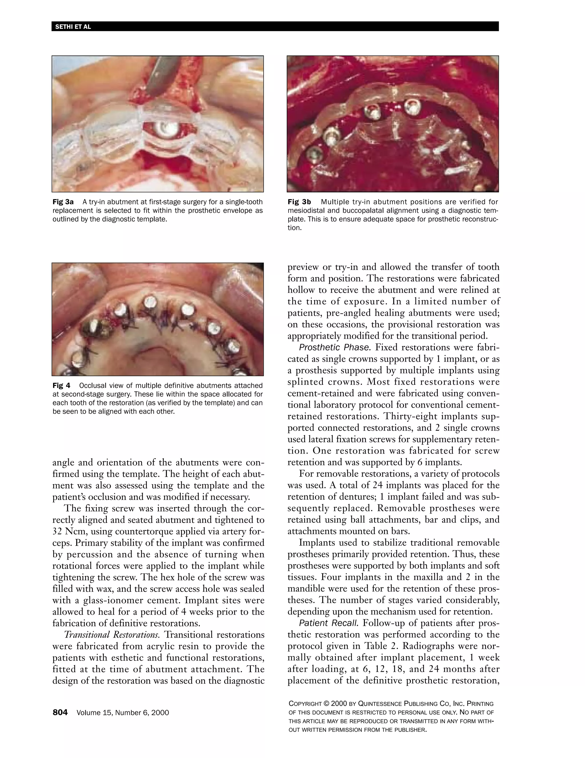 The use of angulated abutments in | PDF