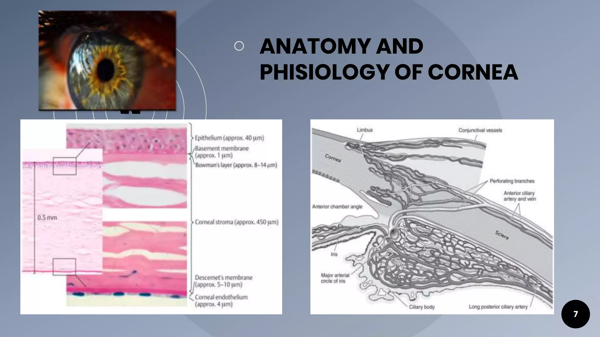 The use of anti vegf in corneal neovascularization | PPTX