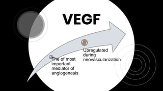 The use of anti vegf in corneal neovascularization | PPTX