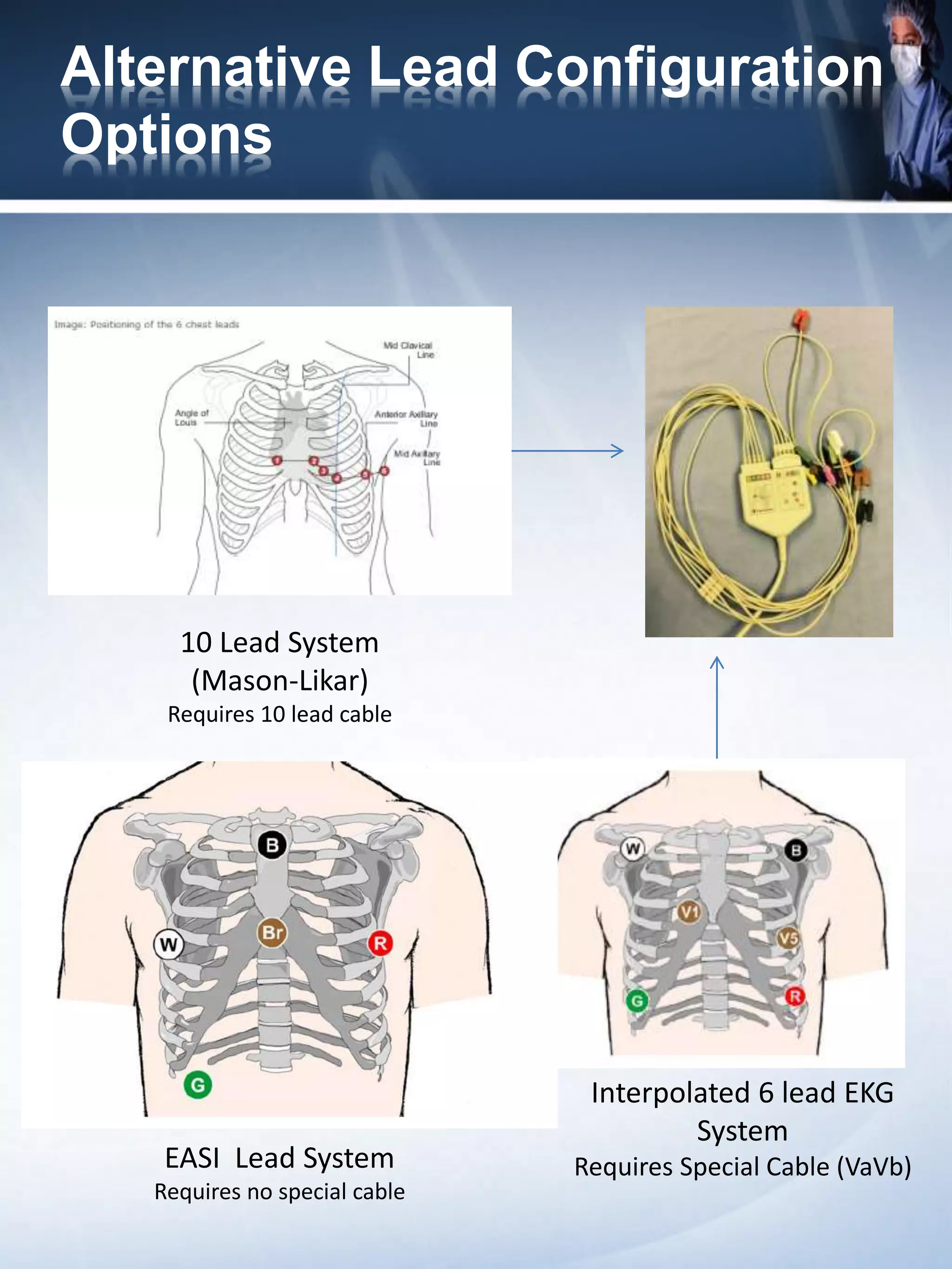 The Use of EKG to Detect Coronary Ischemia | PDF