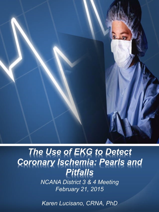The Use of EKG to Detect Coronary Ischemia | PDF
