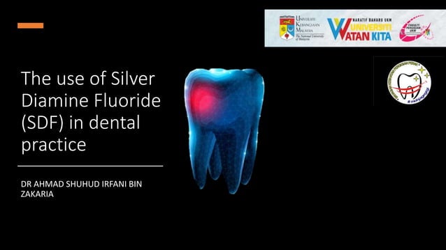 The Use of SDF in Dental Practise_Pergigian Perak.pptx | Oral care ...