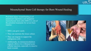 The use of stem cells in burnt wound treatment | PPT
