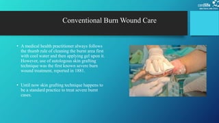 The use of stem cells in burnt wound treatment | PPTX