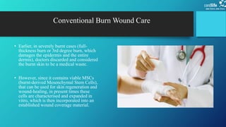 The use of stem cells in burnt wound treatment | PPT
