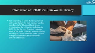 The use of stem cells in burnt wound treatment | PPTX