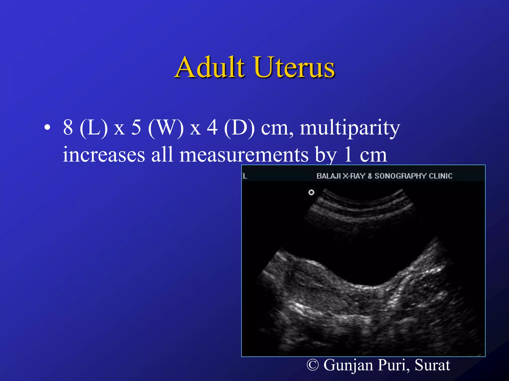 Ultrasound of uterus, part 1 | PPTX