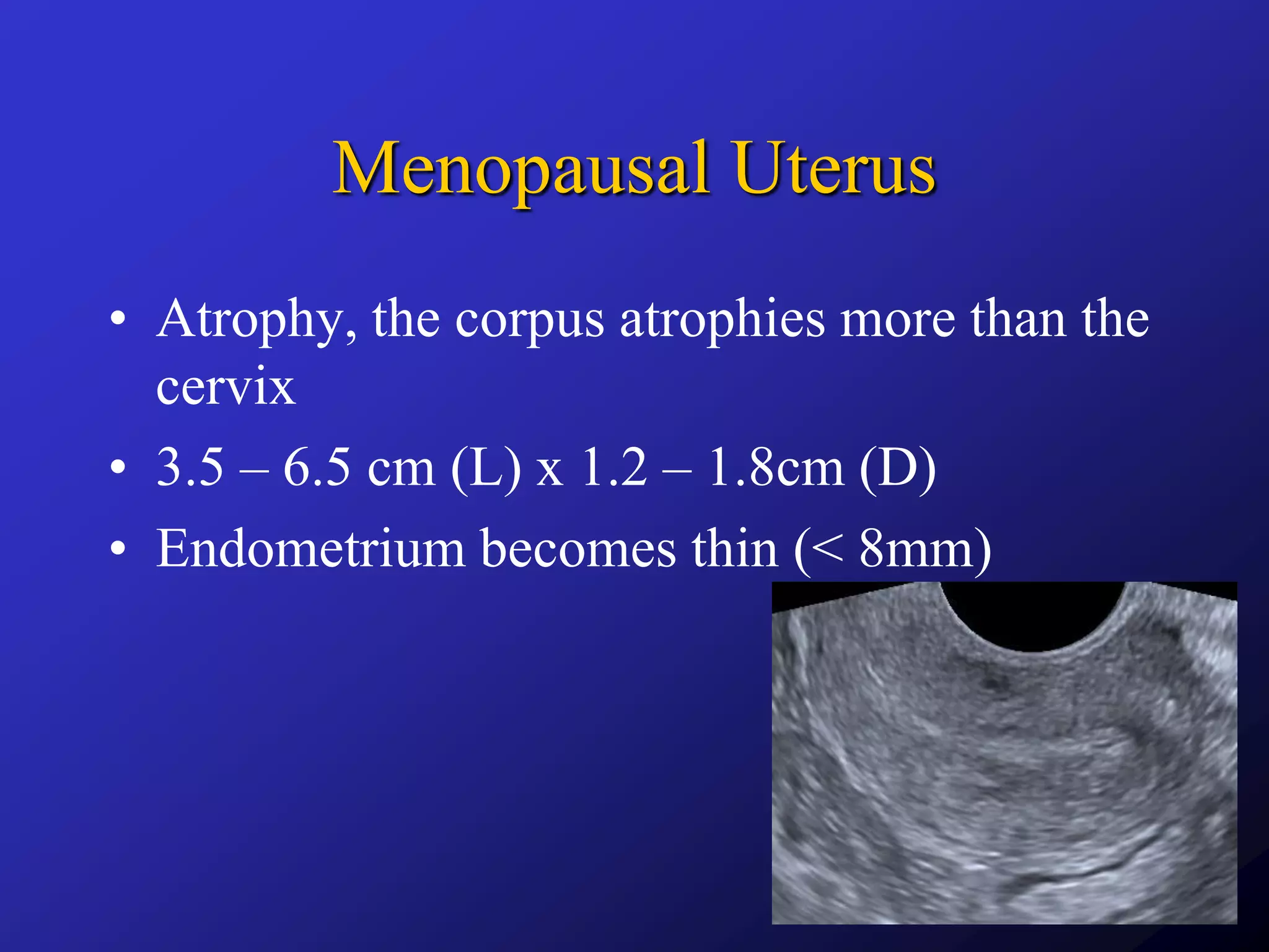 Ultrasound of uterus, part 1 | PPTX