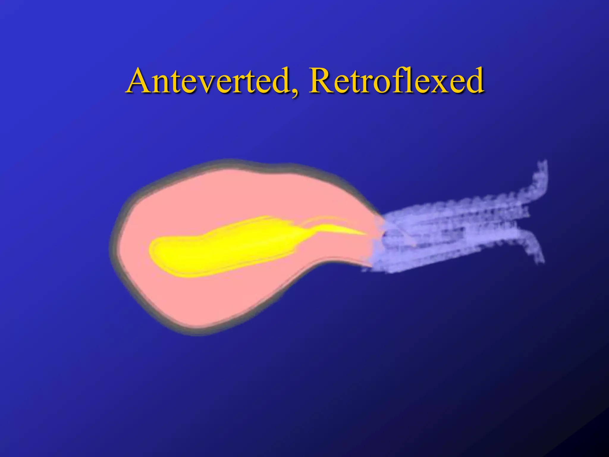 Ultrasound of uterus, part 1 | PPTX