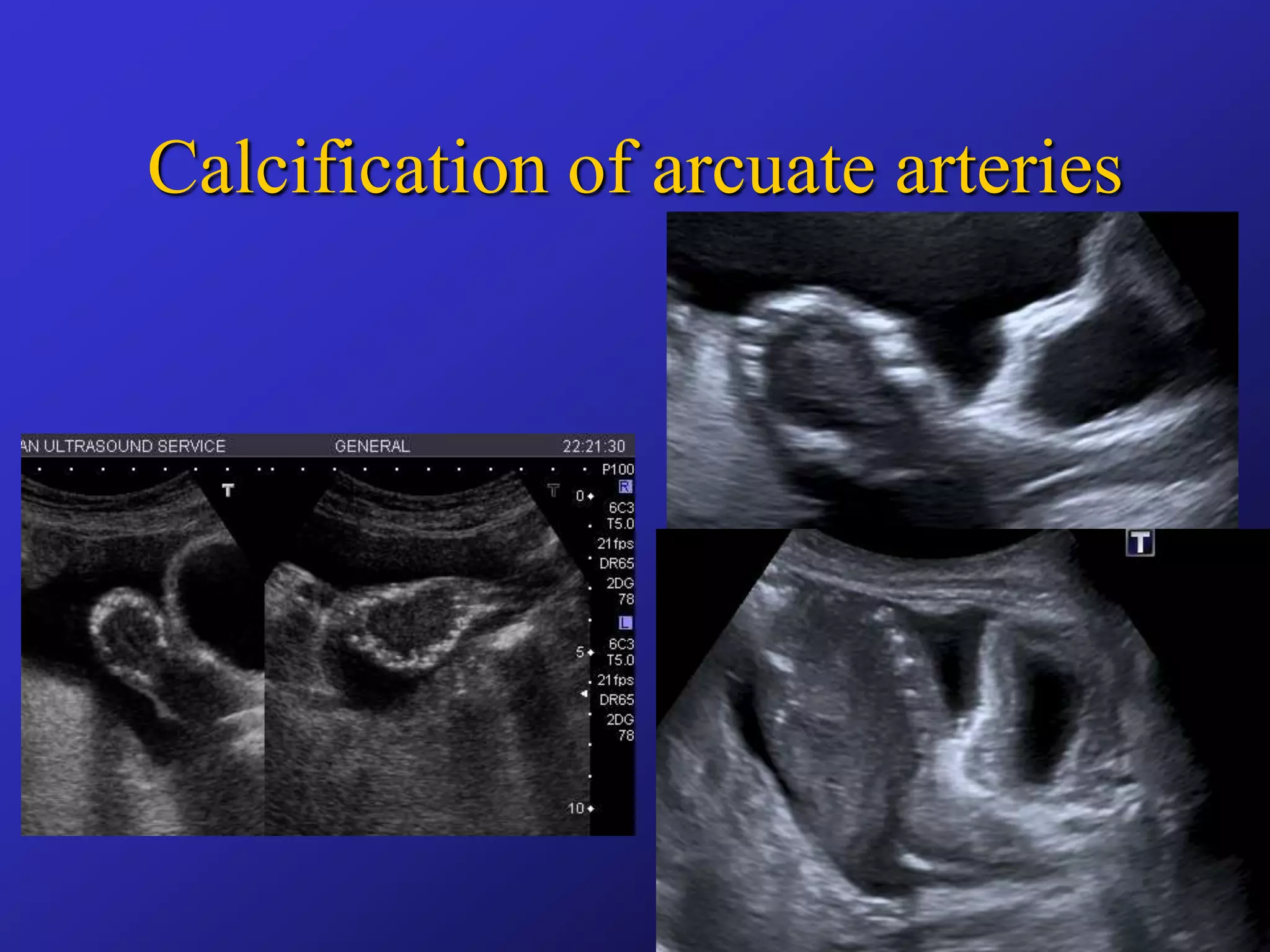 Ultrasound of uterus, part 1 | PPTX