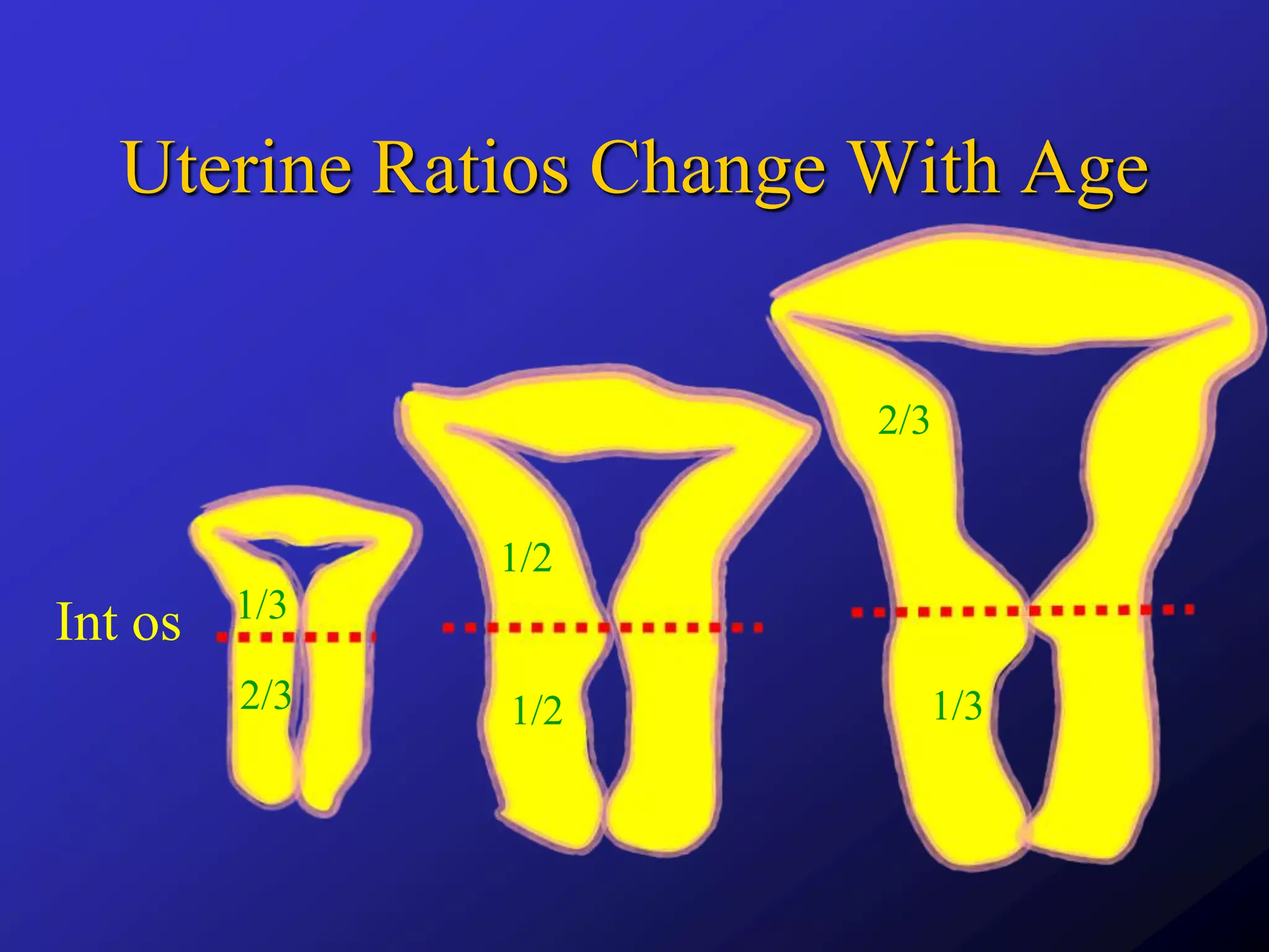 Ultrasound of uterus, part 1 | PPTX